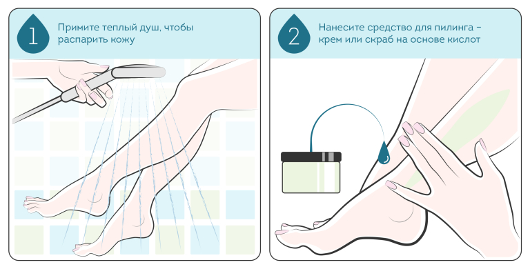 Отшелушивание кожи лица: обзор 4 средств для очищения